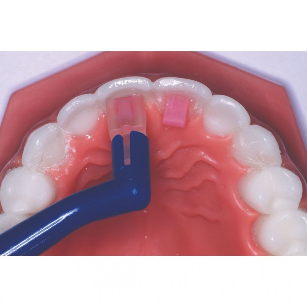 Khuôn tạo nâng khớp răng cửa Bite Turbo - Reliance