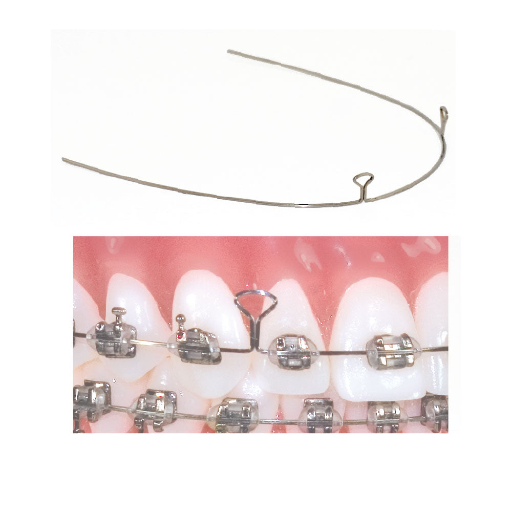 Dây Keyhole Loop TruForce Stainless Steel Retraction 2 keyhole - Ortho